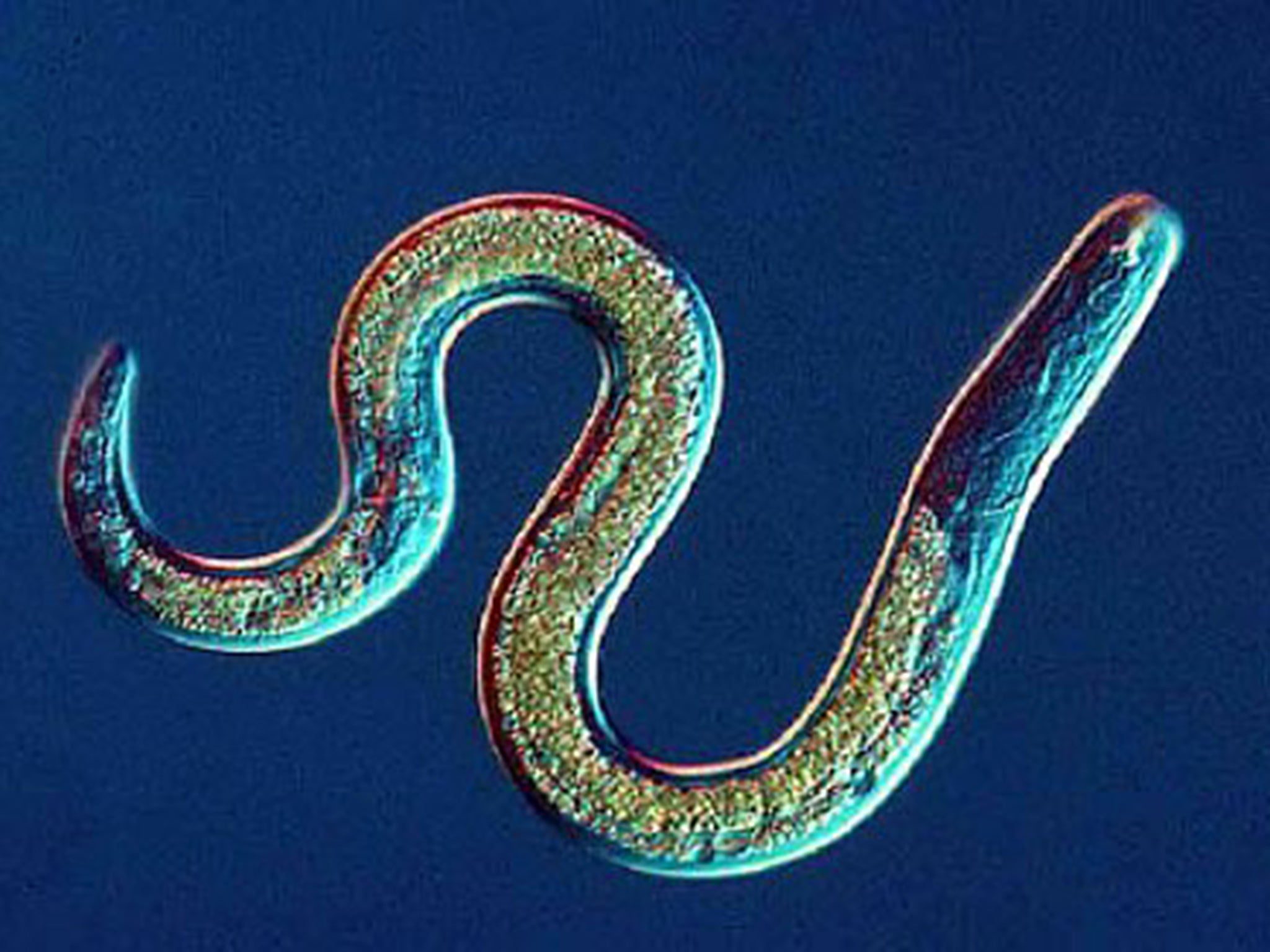 Watch New Video of Hundreds of 'Vinegar Eels' Swarm into Hypnotic Dance ...